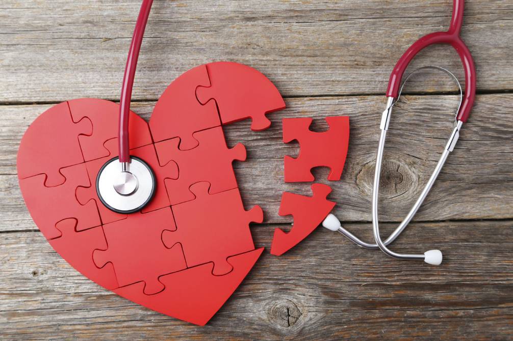 Patah hati lalu mati karena broken heart syndrome